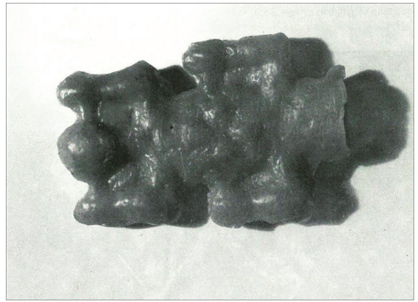 Infertile woman’s wax zena-zaba (woman-frog), i.e. womb