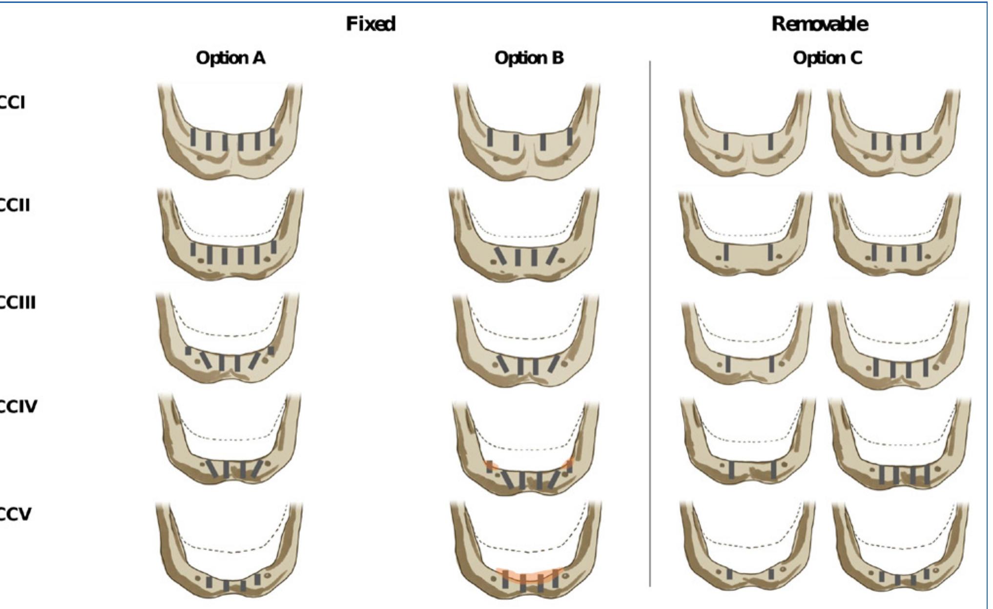 Bone atrophy classification of the mandible, and associated