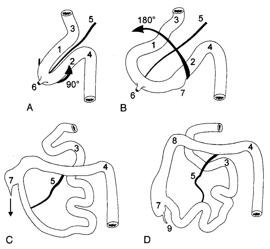 (PDF) APPENDIX AND CECUM Embryology Anatomy and Surgical Applications