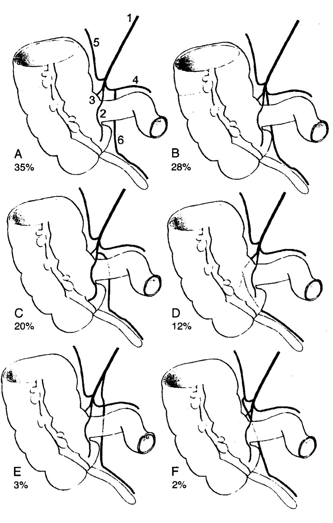 Figure 5 - from APPENDIX AND CECUM Embryology Anatomy and
