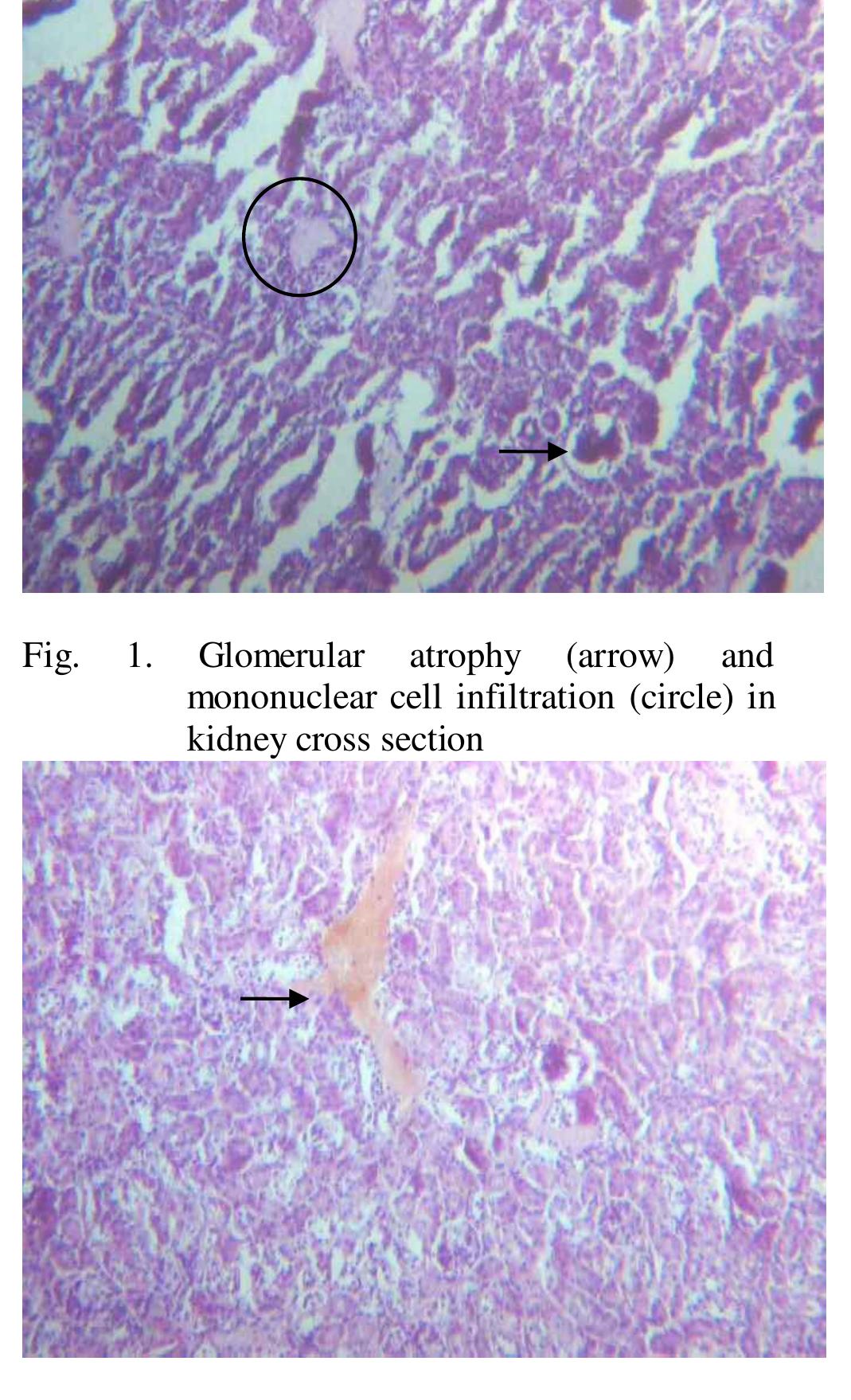 Necrosis and mononuclear cell infiltration in kidney cross