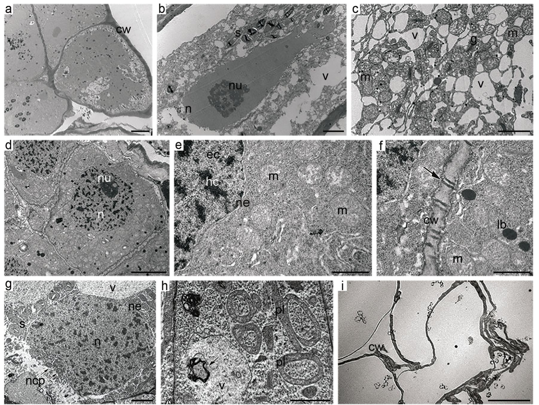 Transmission electron microscopy of a. angustifolia