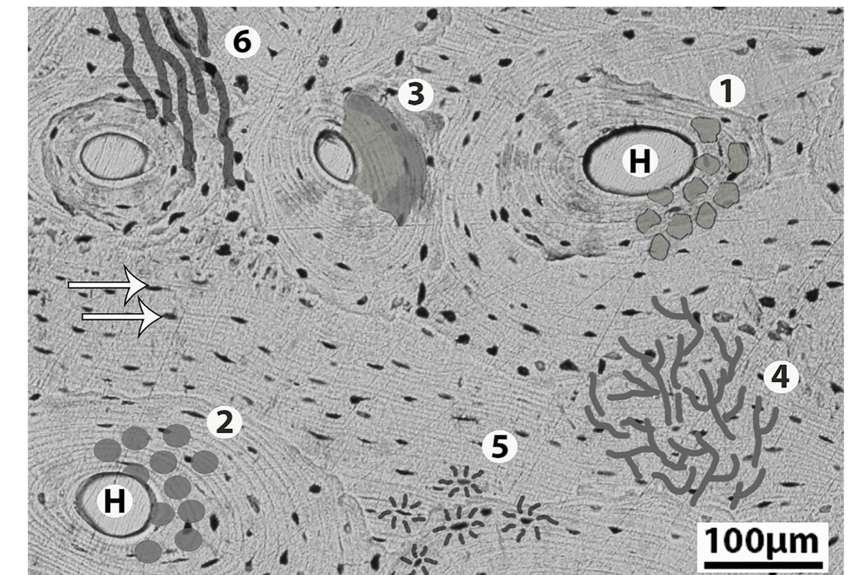 Micrograph of transverse adult femoral thin section