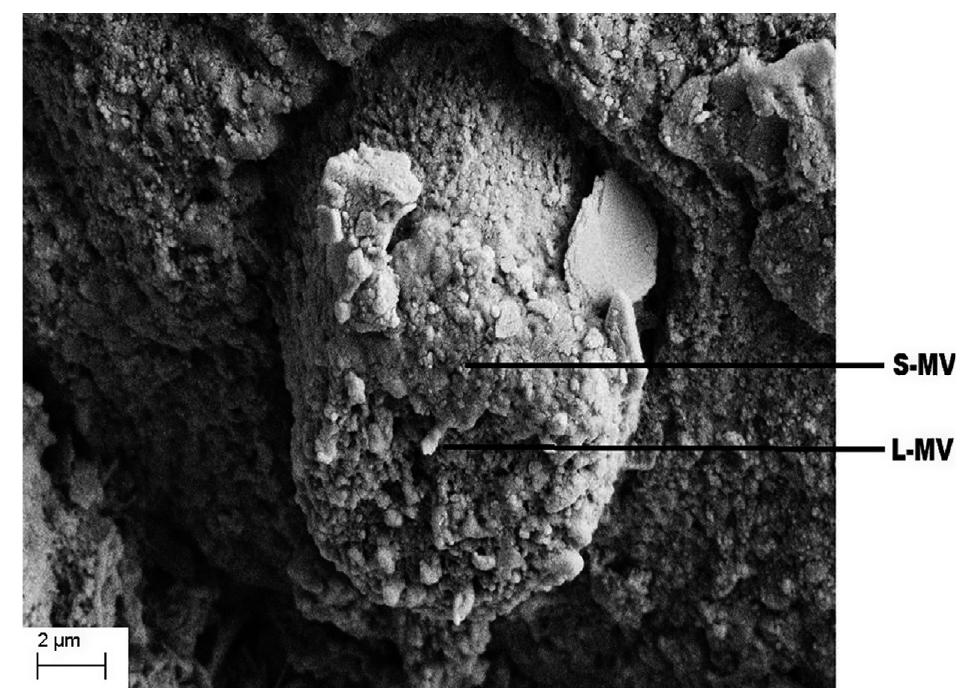 —micrographs showing two types of microvillar projections: