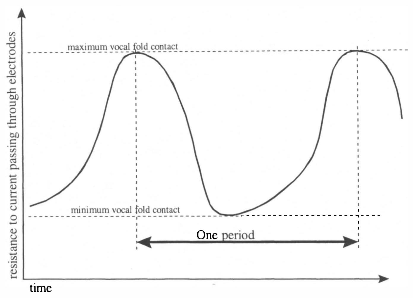 -5: stylised laryngograph waveform showing period of vocal