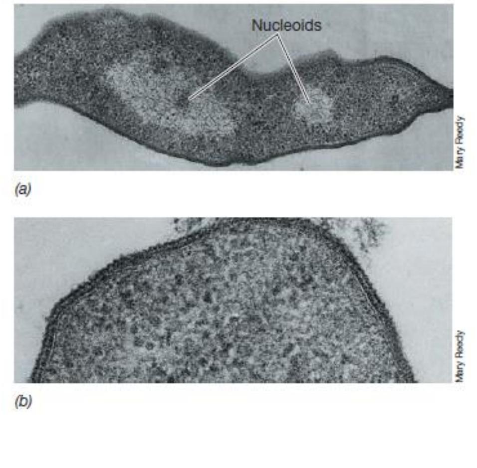 Figure 24 - Archaea Morphology, Physiology ,Biochemistry and