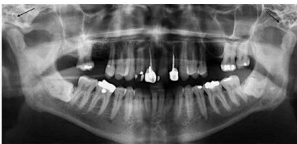 (PDF) Interpretation of panoramic radiographs