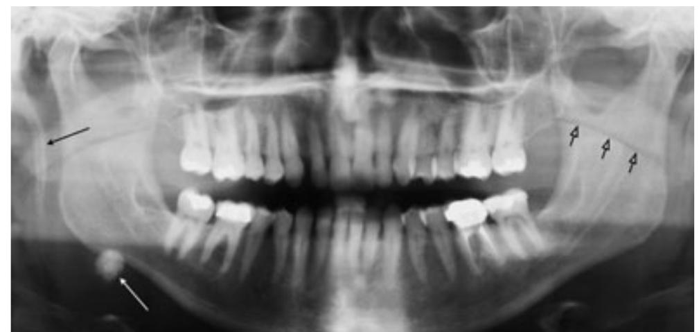 (PDF) Interpretation of panoramic radiographs