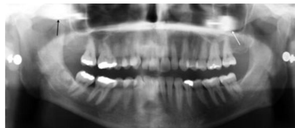 (PDF) Interpretation of panoramic radiographs