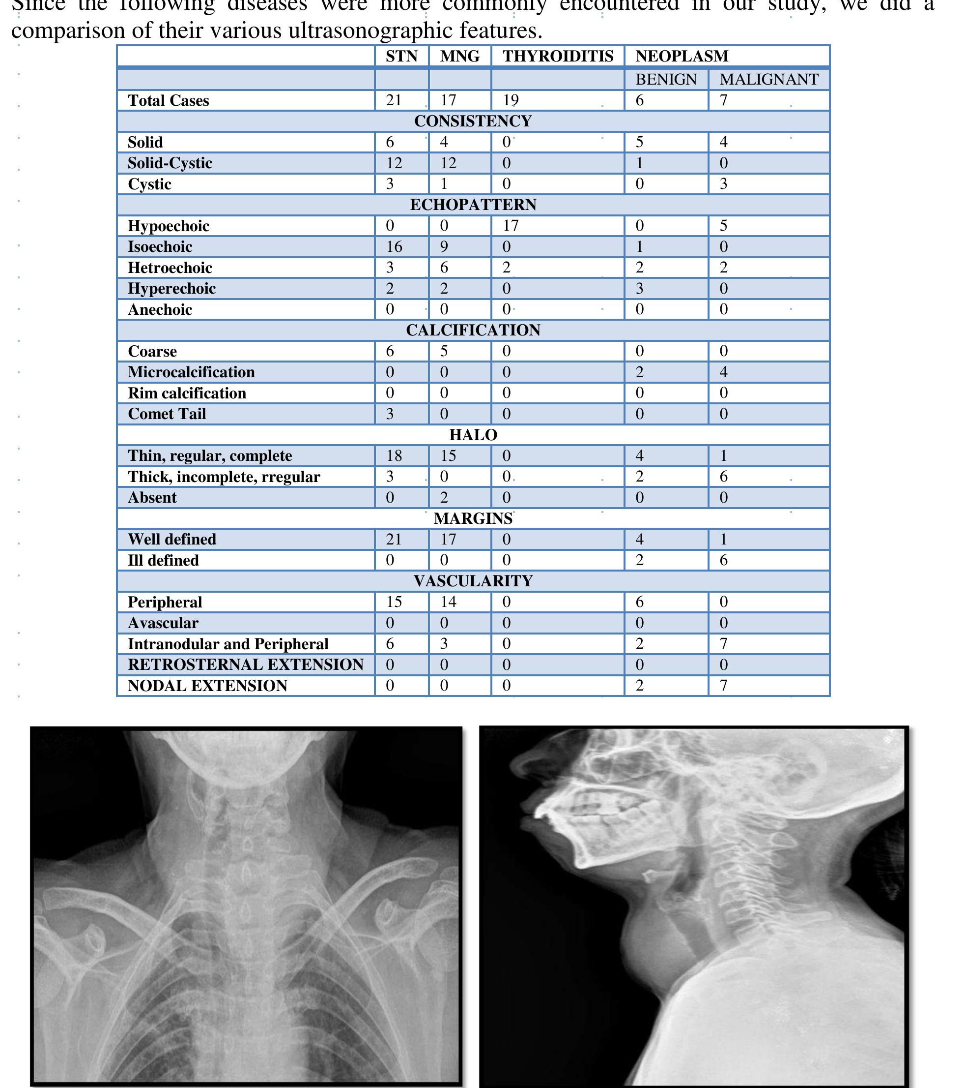 Image no 1 & 2: enlarged thyroid gland: x-ray soft tissue