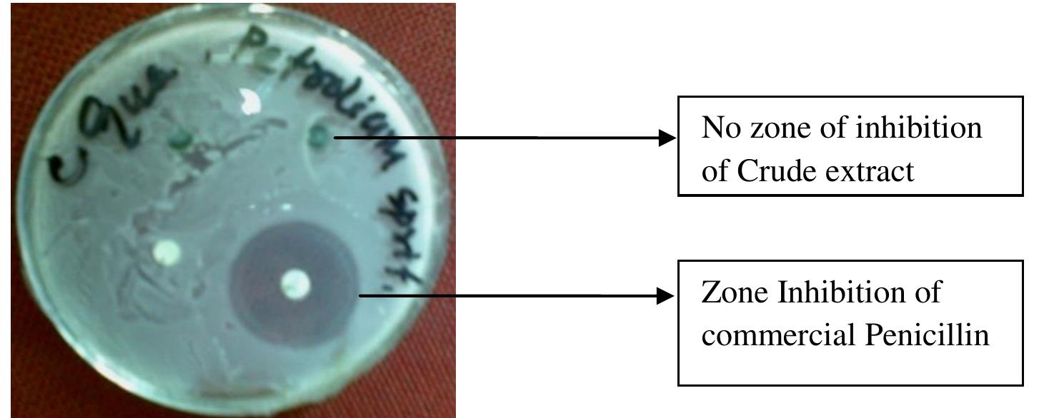 No zones of inhibition with petroleum spirit extract of c.