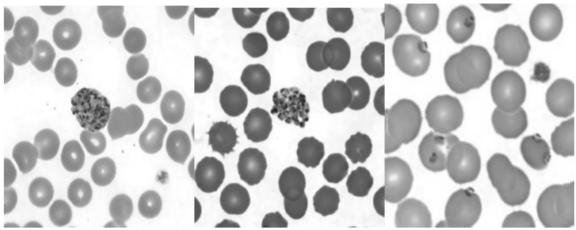 5 samples of already stained blood smear images showing