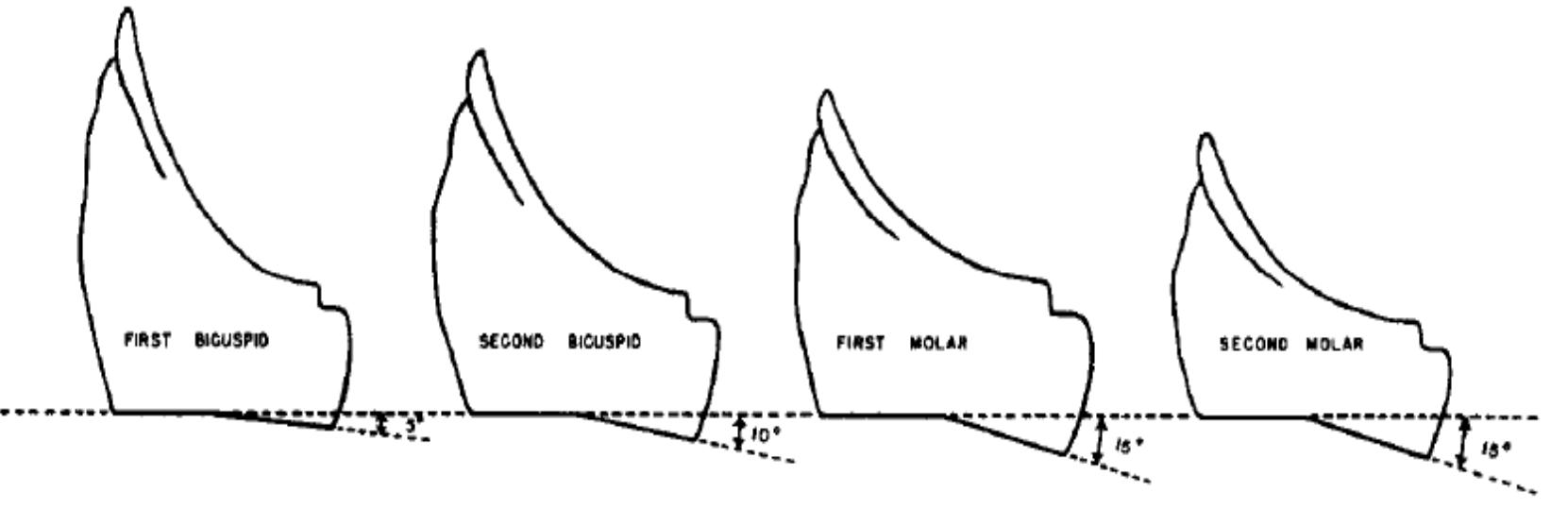 Variations in the inclination of the lingual cusps of