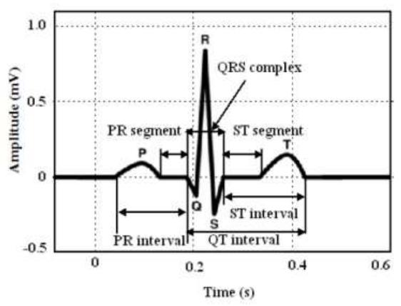 Schematic representation of normal ecg waveform [3]. ecg