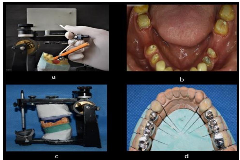 Figure 5 - from Stepwise approach to functional and