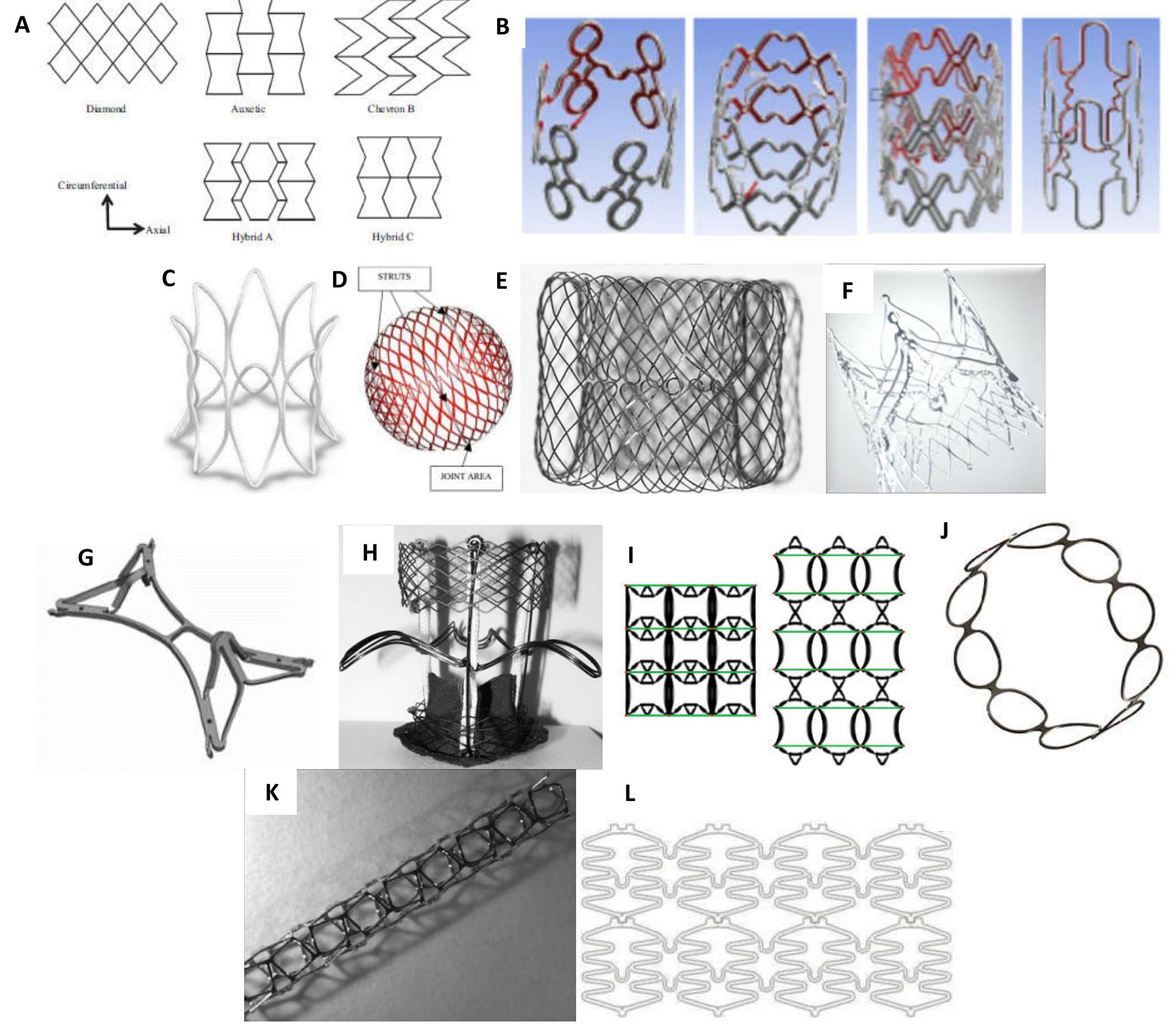 -15. examples of stent structures proposed in the
