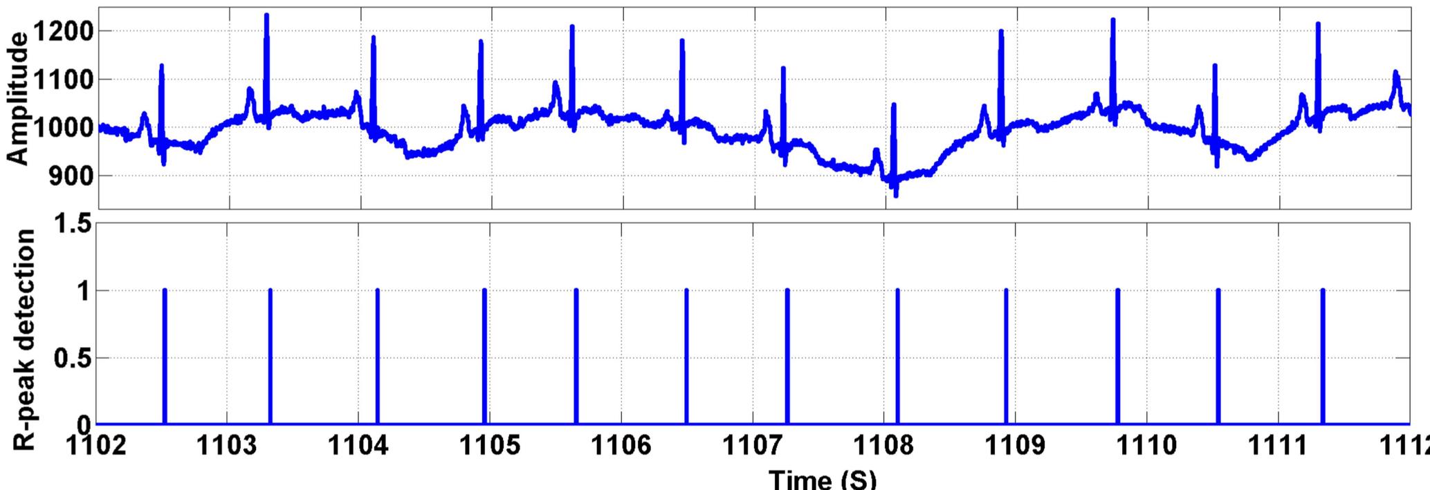 Ecg waveform and r-peak localisation plot for segment