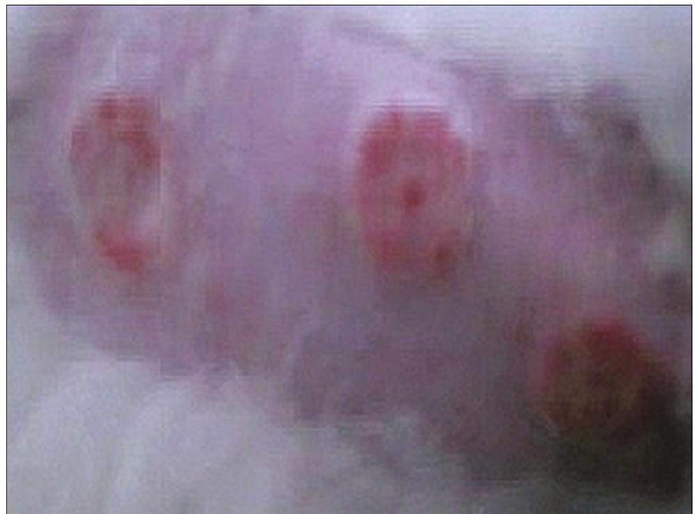 -3: lesions from microsporum canis in body part of cat.