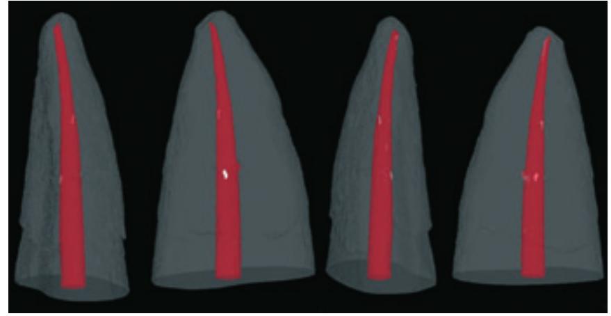 3d model of a sample filling using system b technique