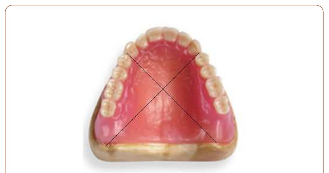 The center of each fabricated maxillary denture was located