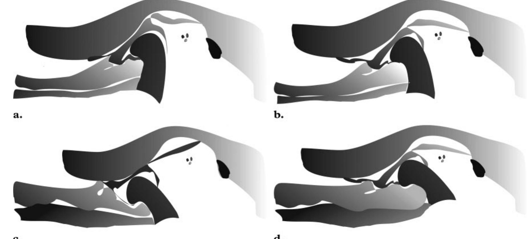 Drawings illustrate tmj function. (a) initial closed-mouth