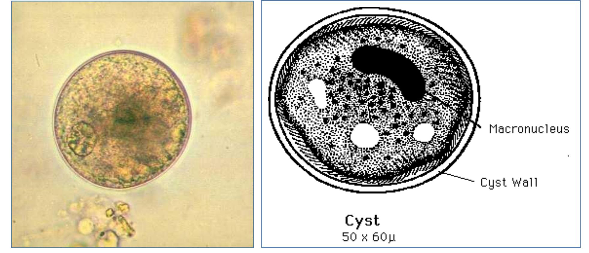 Balantidium Coli Trophozoite Morphology