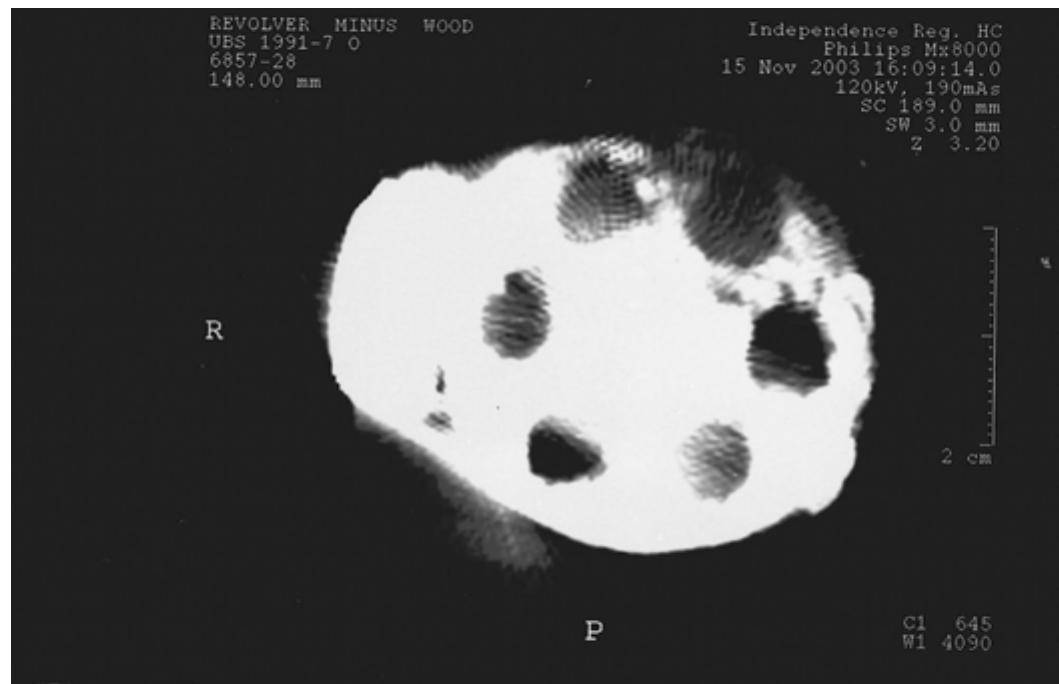 Cat scan image of cross-section of unloaded cylinder—colt,