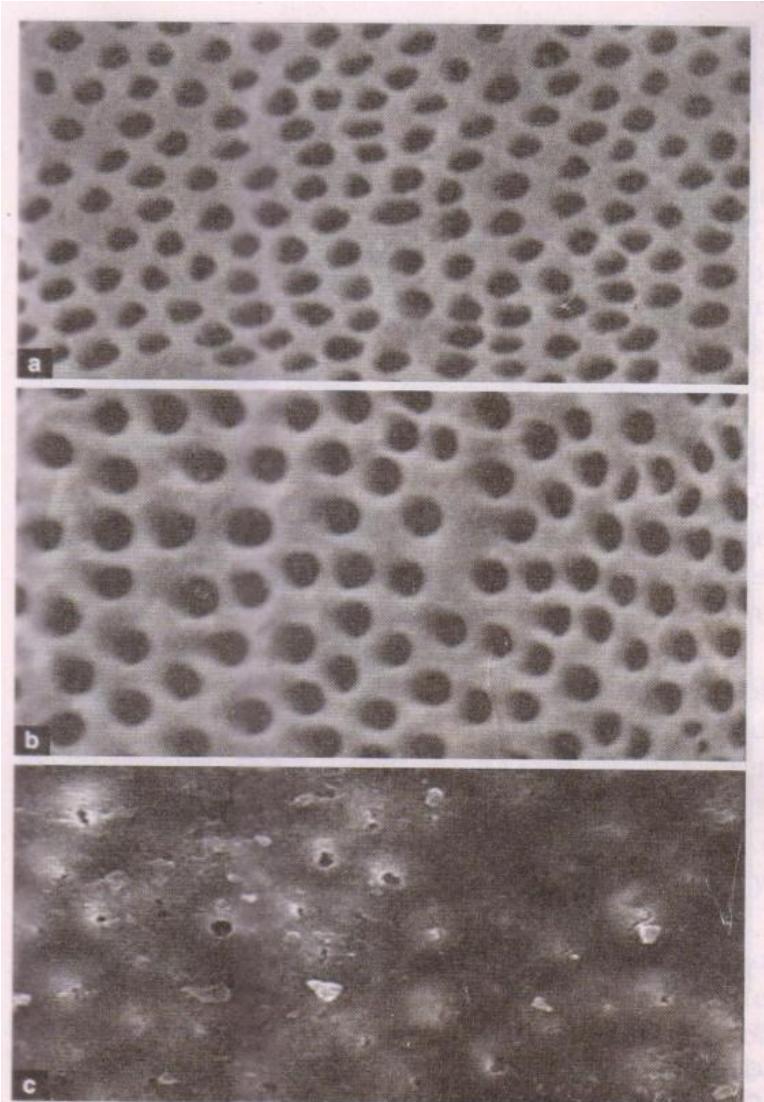 Figure 2 - from Smear Layer in Endodontics