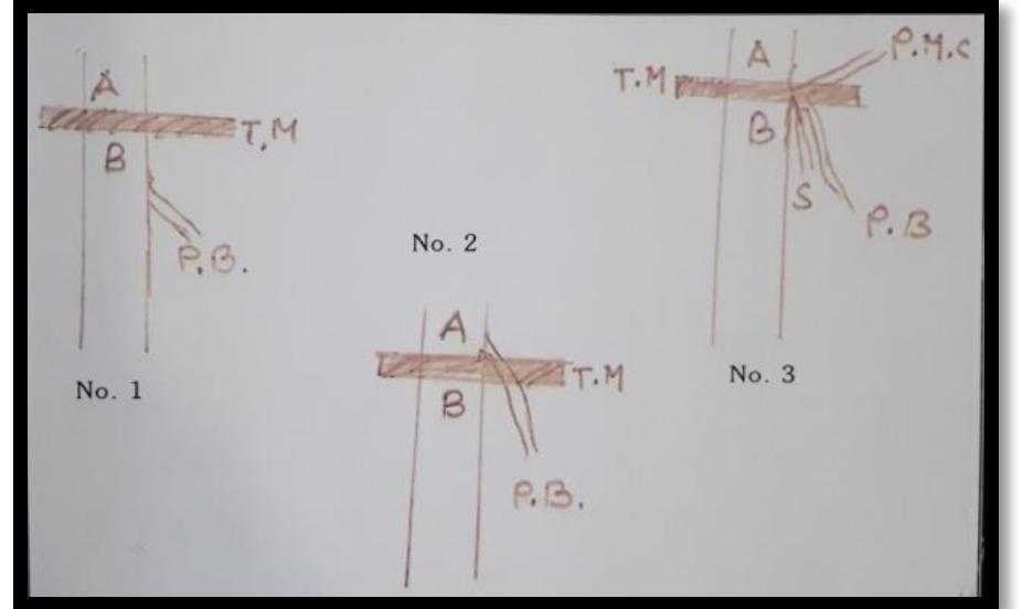 Figure 1 - from A study on profunda brachi artery in adult