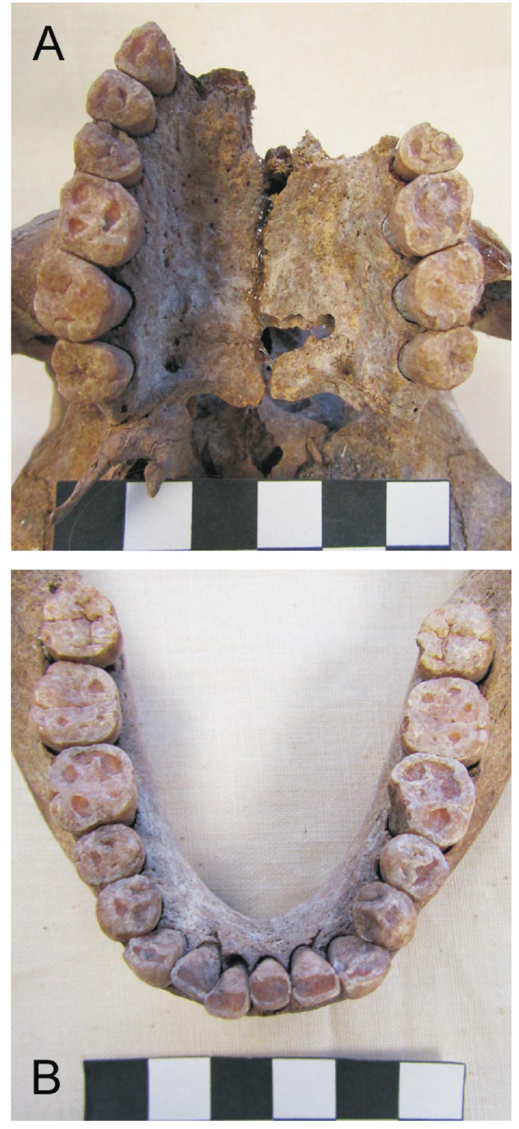 Occlusal views of the maxilla (a) and mandible (b). scales