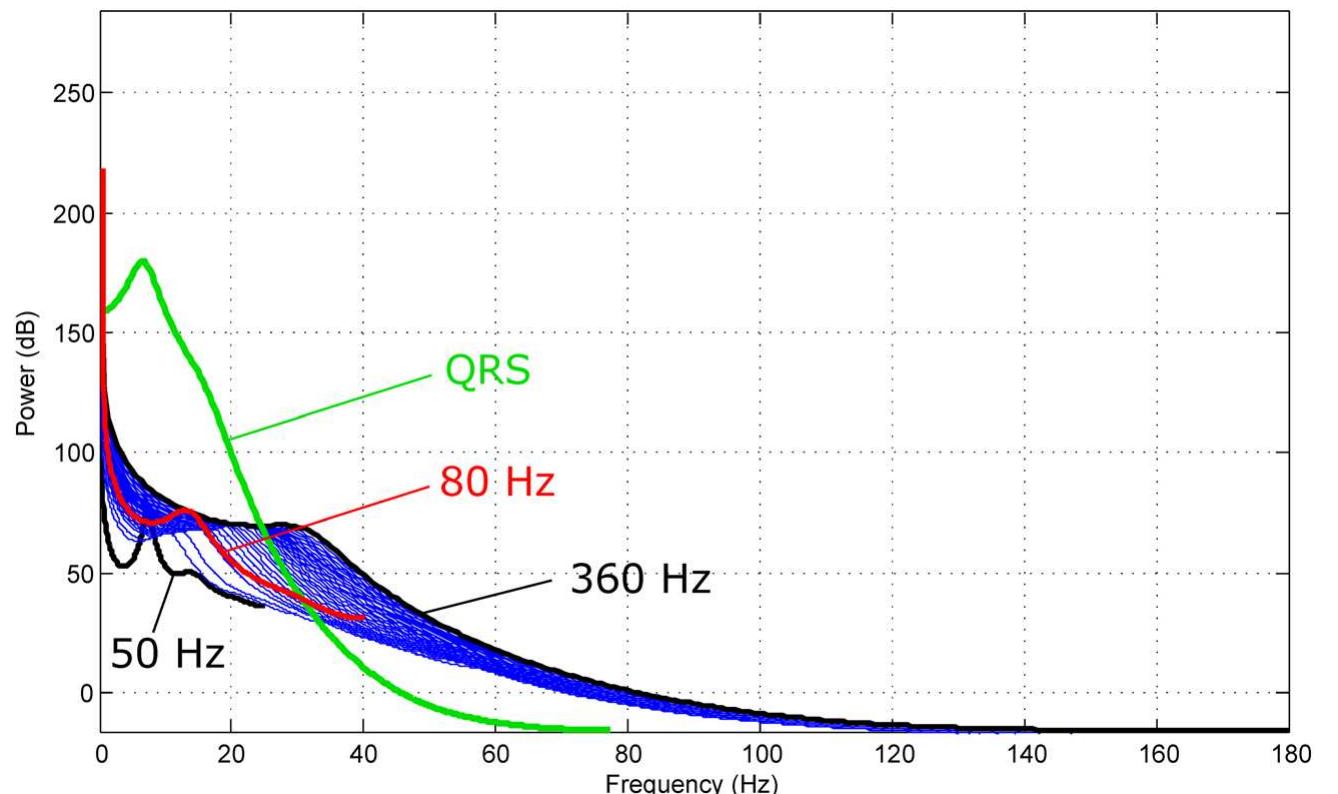 Power spectra of ecg signal (first 60 seconds of record #100