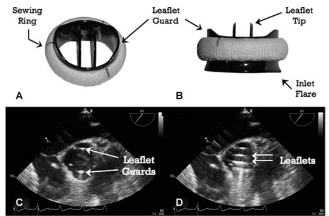 The inlet flare gives the valve a prominent pro- file, and