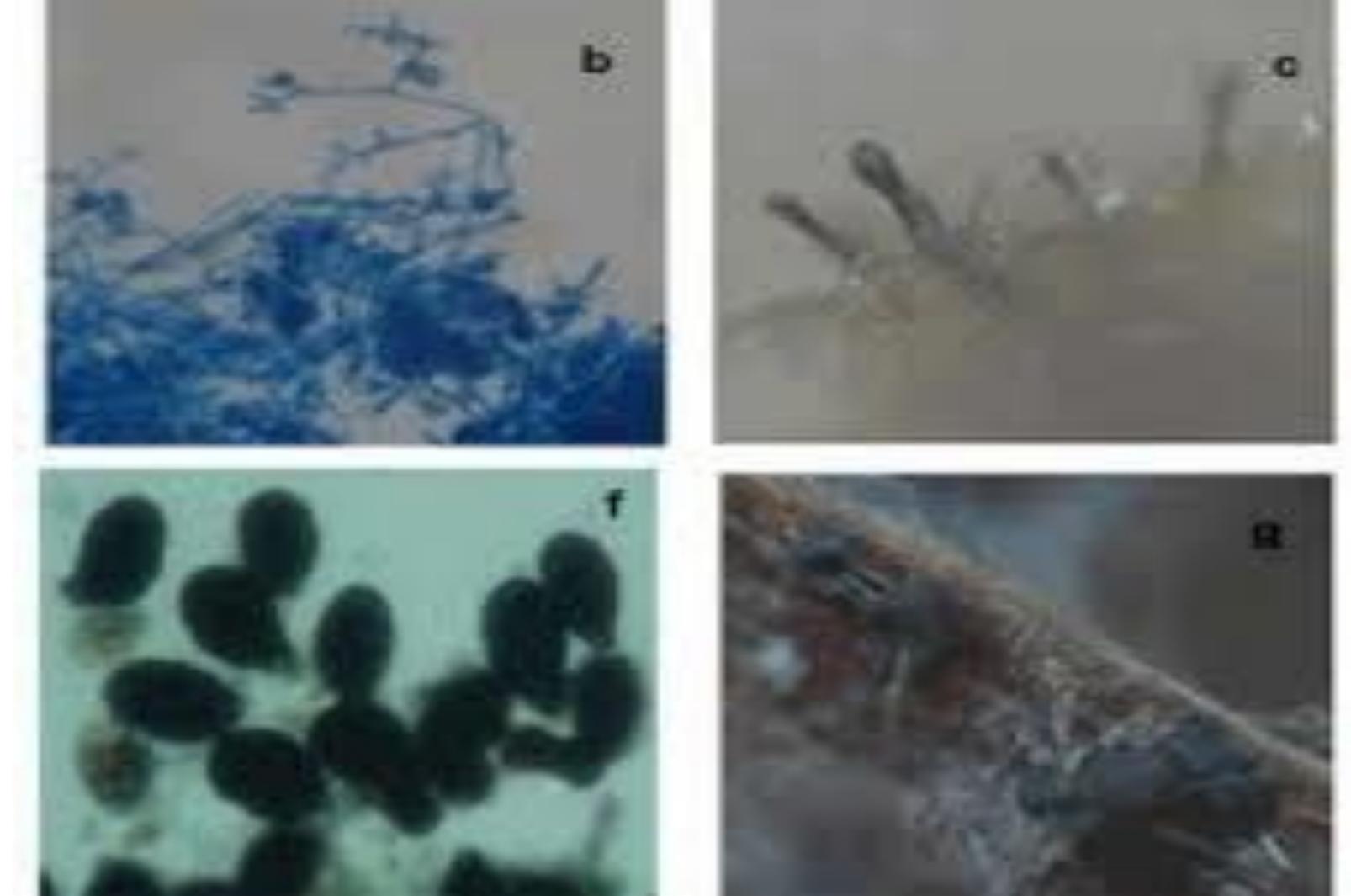 : different types of endophytes with conidial