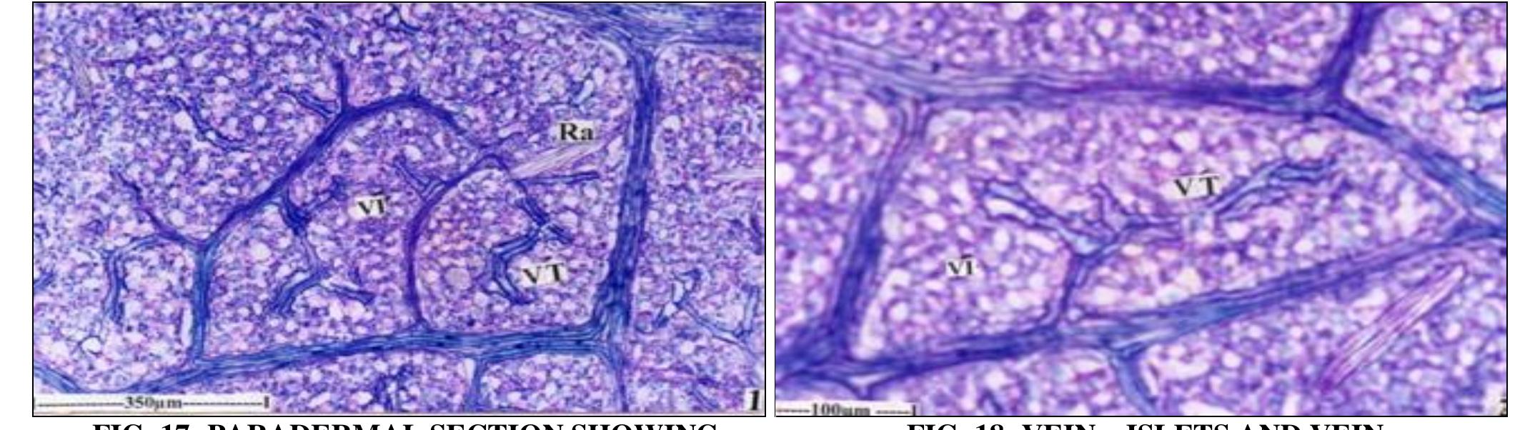 Lamina: the lamina is uniformly thick with smooth and even