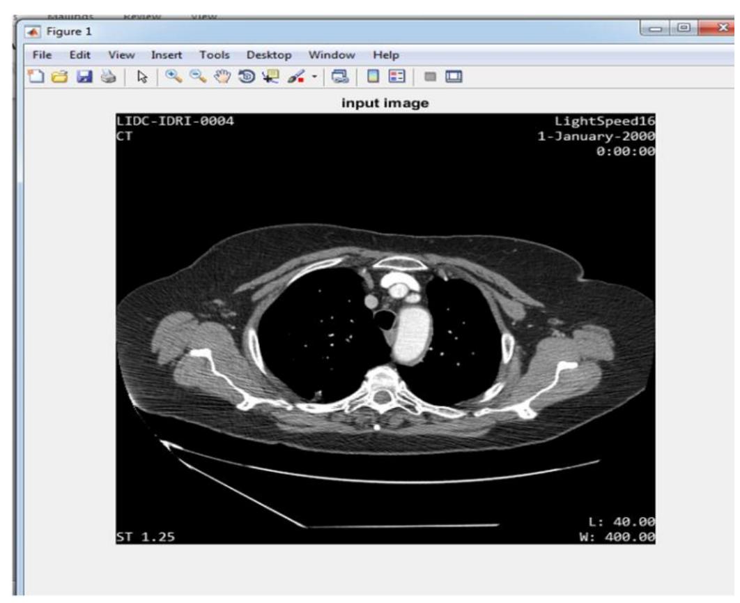 We implement and analyse the image processing method for