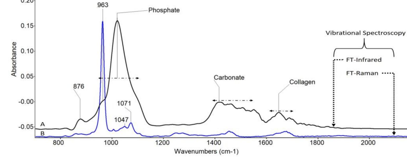 The ft-infrared spectra of the ancient human bone (a) and