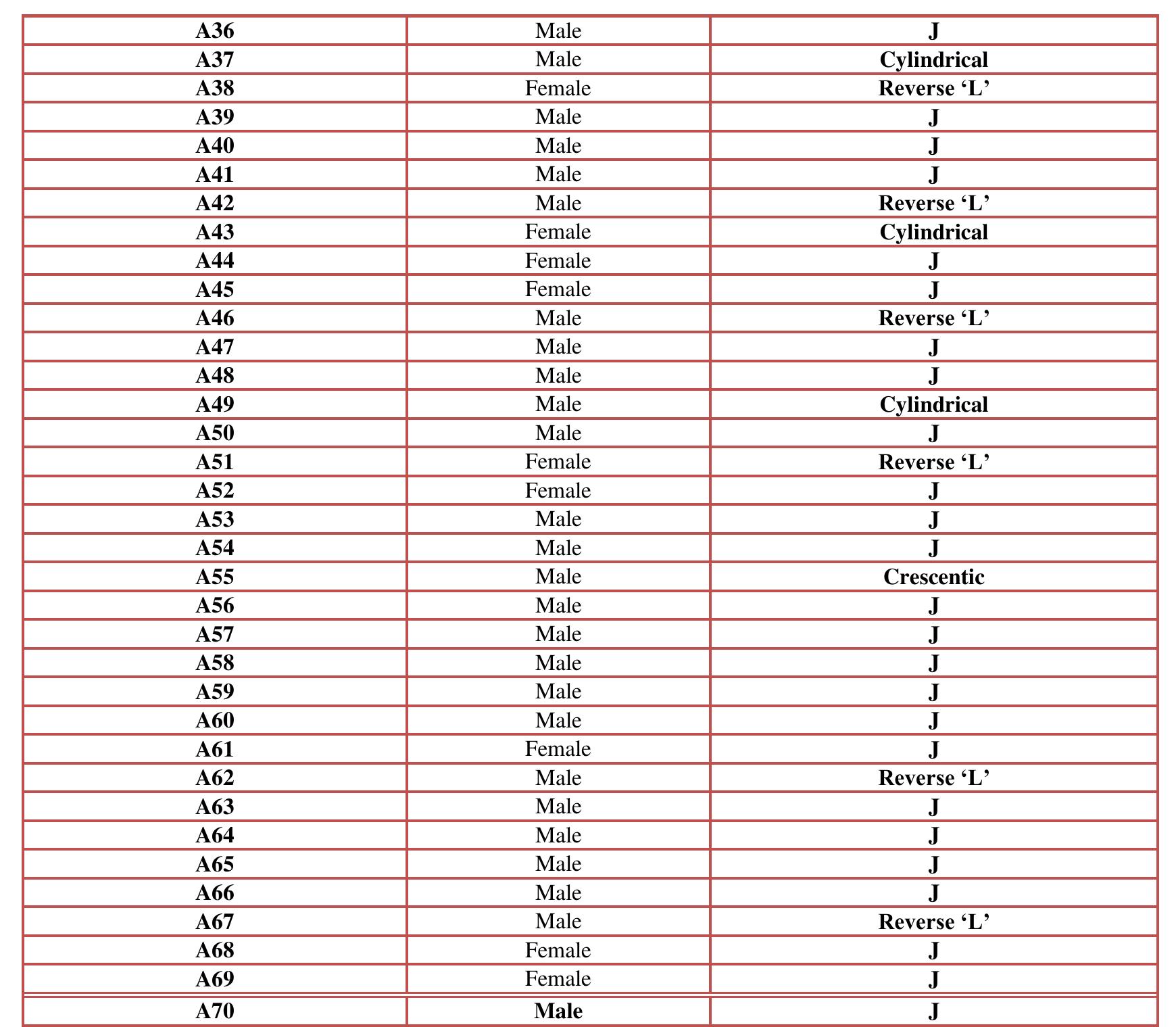 Anatomy of stomach and its variations capacity: the mean