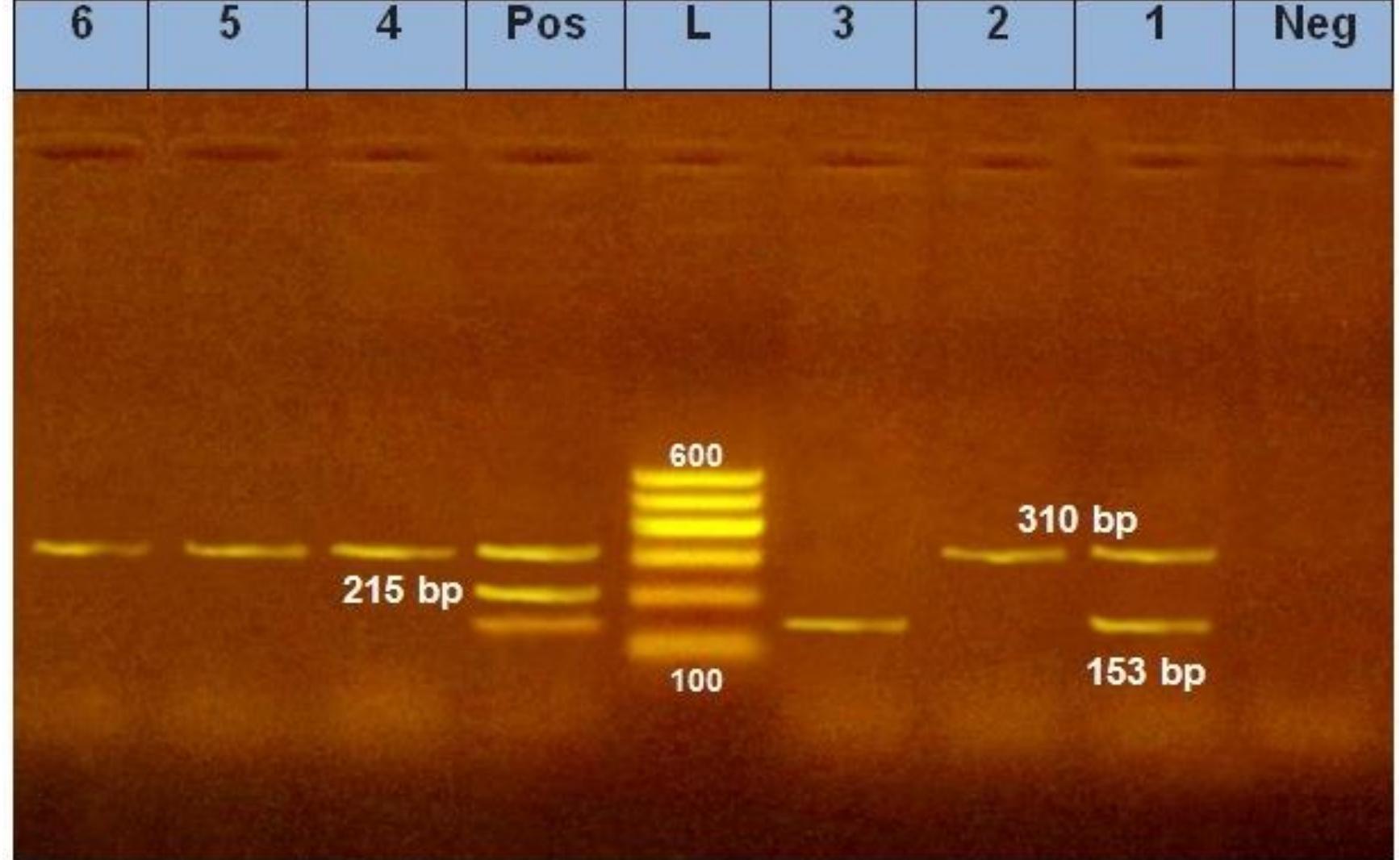 Agarose gel electrophoresis of multiplex pcr of