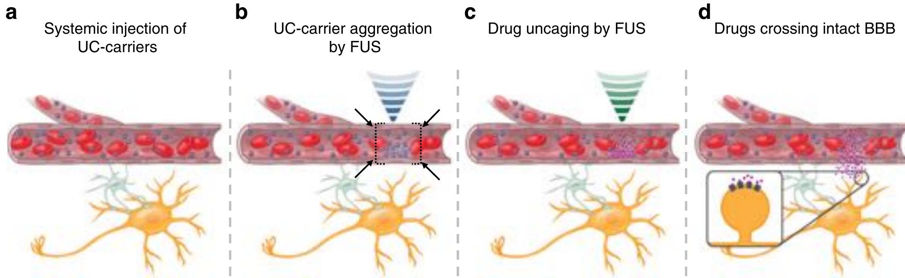 Concept of focal aggregation and uncaging of
