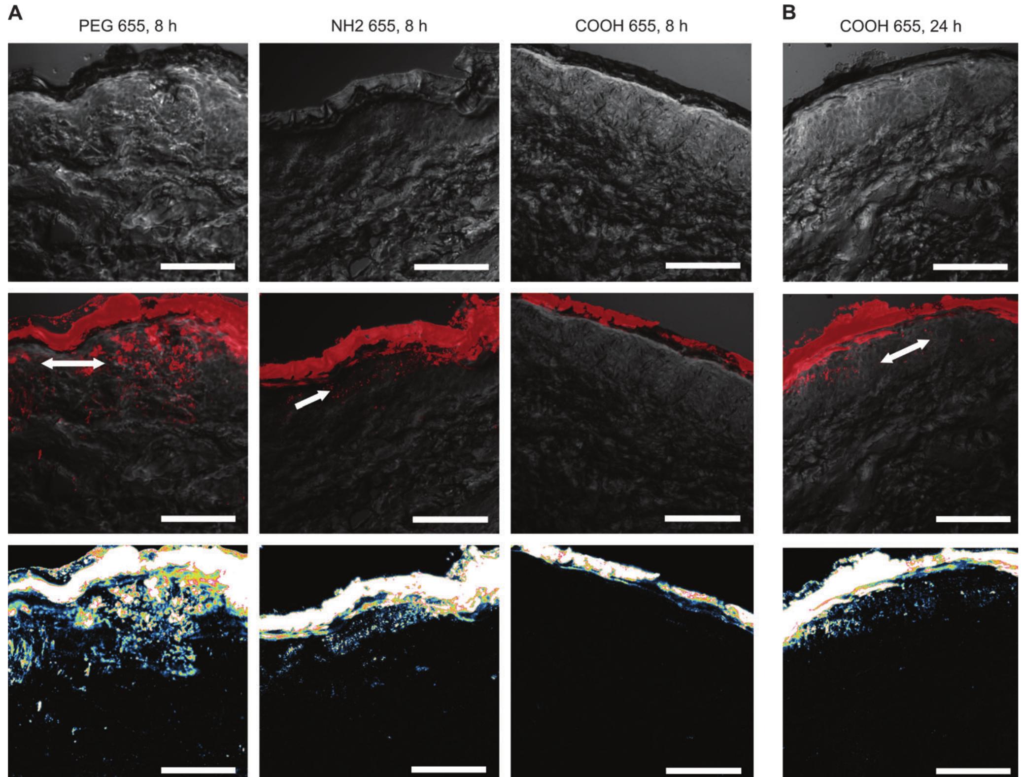 A. confocal scanning microscopy of skin treated for 8 h with