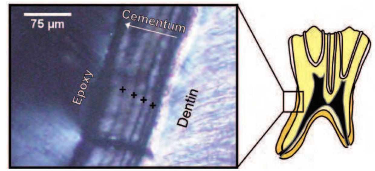 1 ~ diagram of ungulate tooth indicating the location of the