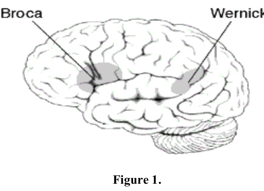 Figure 1 - from APHASIA: CHARACTERISTICS AND TEACHING