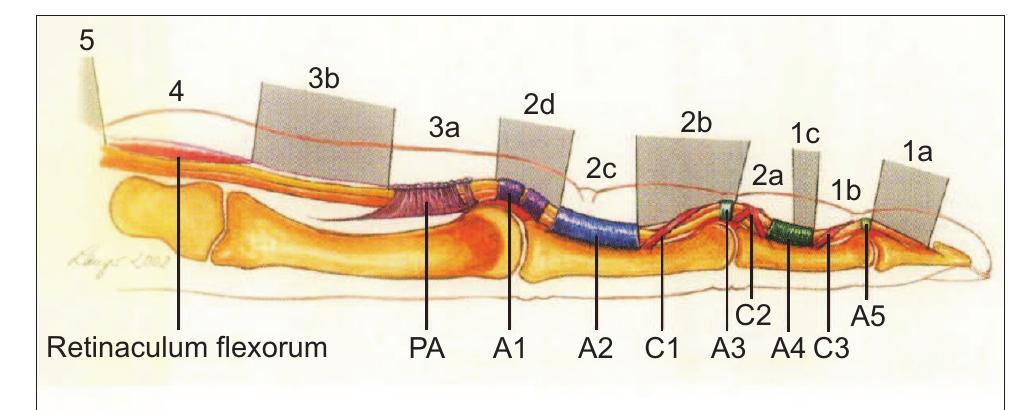 Zones and subzones of the finger flexor tendons. a: anular
