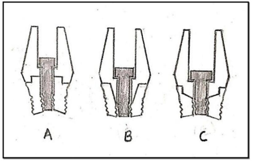 A) implant to abutment connection: morse taper connection