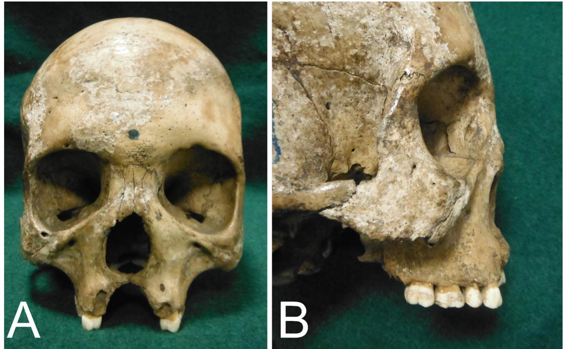 Figure 1 - from “Dead to the world, but alive unto God”: