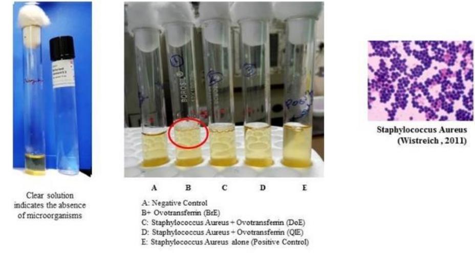 Bhi- broth diffusion method using 0.5 mc farland standard as