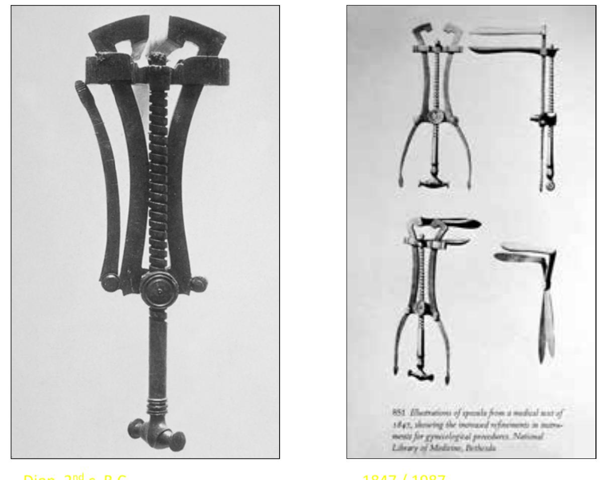 Two vaginal specula, with 2000 years of difference,