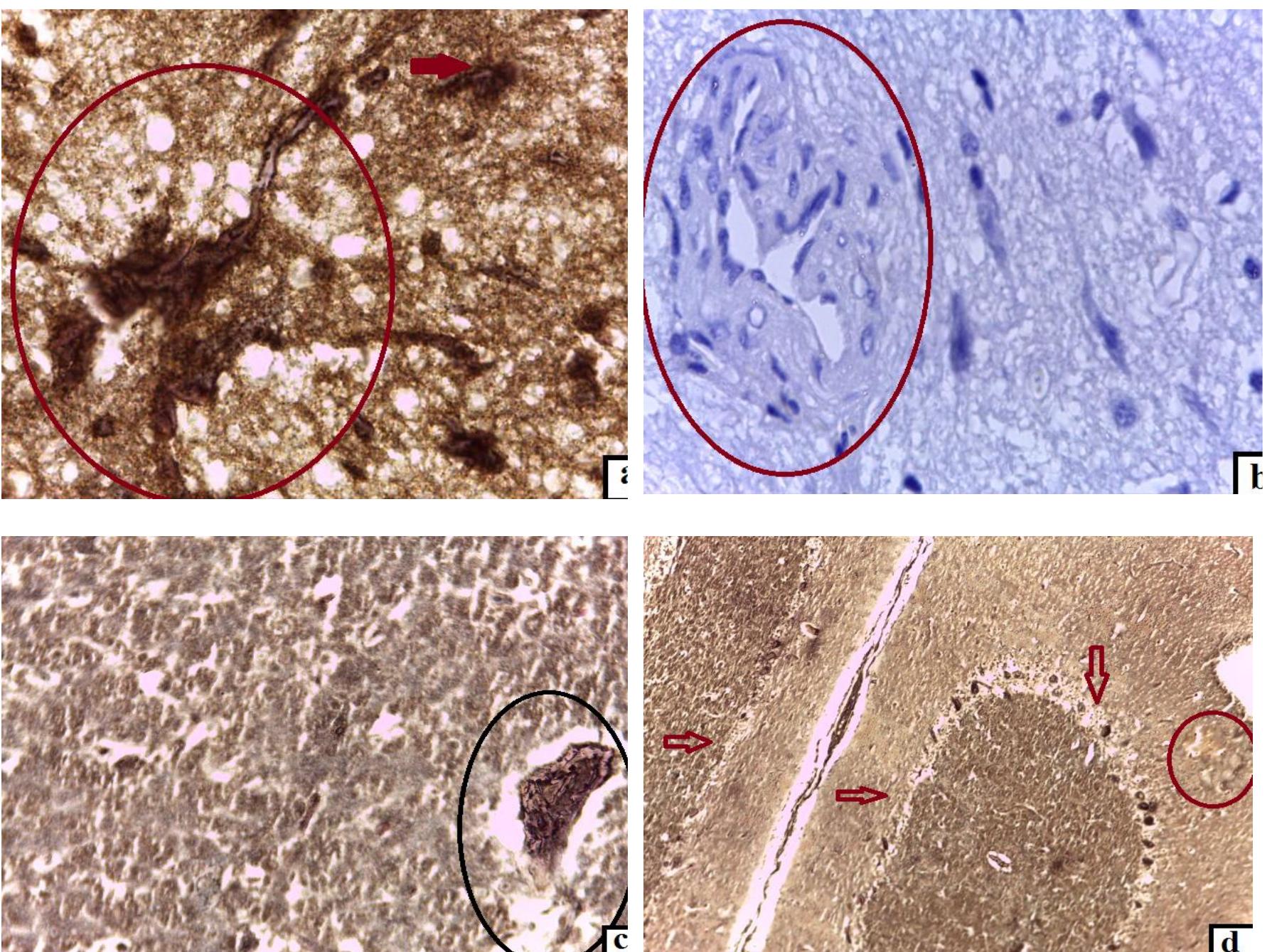 Oee ——— sess ! = —_ _ ss ss fig 3. a. cerebral cortex.