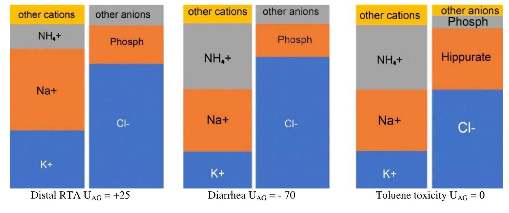 ‘igure 5: urine anion gap. the first diagram represents a
