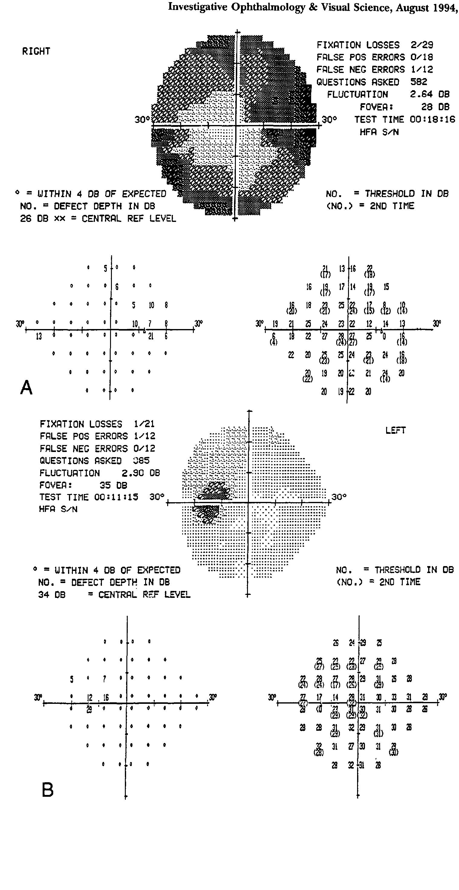 Figure 5 - Interpretation of automated perimetry for
